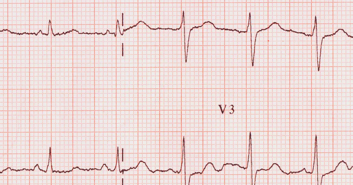 Heart tests and cancer treatment
